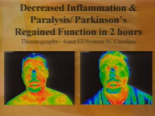 EESystem - Energy Medicine - New Zealand