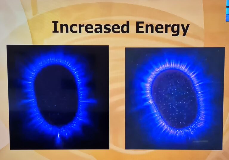 EESystem - Energy Medicine - New Zealand