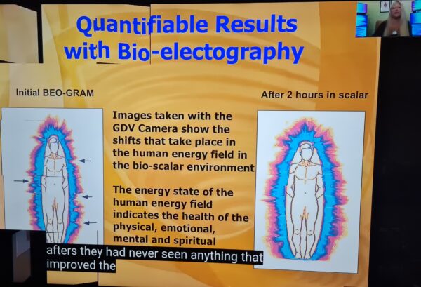 EESystem - Energy Medicine - New Zealand