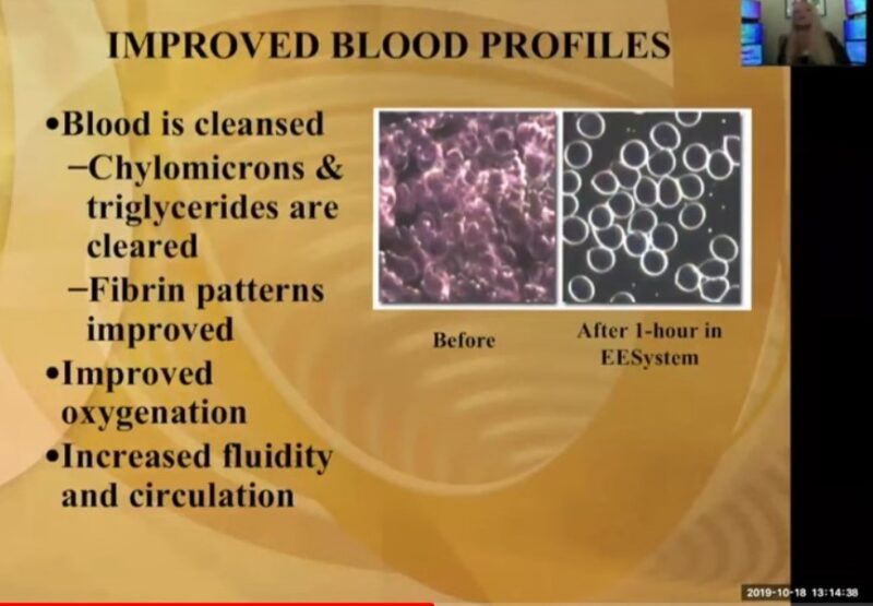 EESystem - Energy Medicine - New Zealand